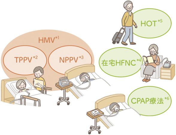 NPPV・HFNC・CPAPの特徴を解説。在宅酸素療法・在宅人工呼吸療法の基礎知識 - NsPace（ナースペース）-家で「看る」あなたを支える