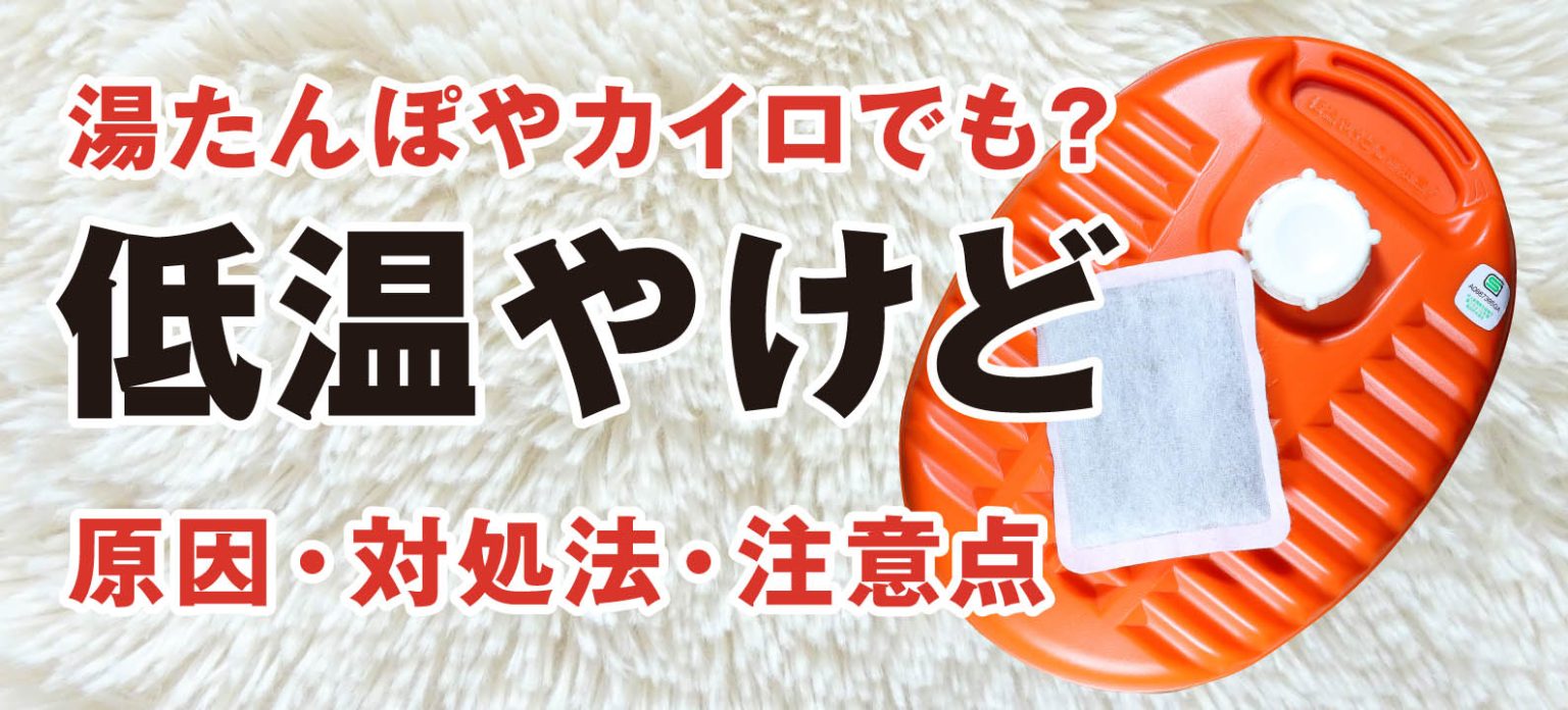 低温やけど（低温熱傷）とは？初期症状や対処法について解説 - NsPace（ナースペース）-家で「看る」あなたを支える